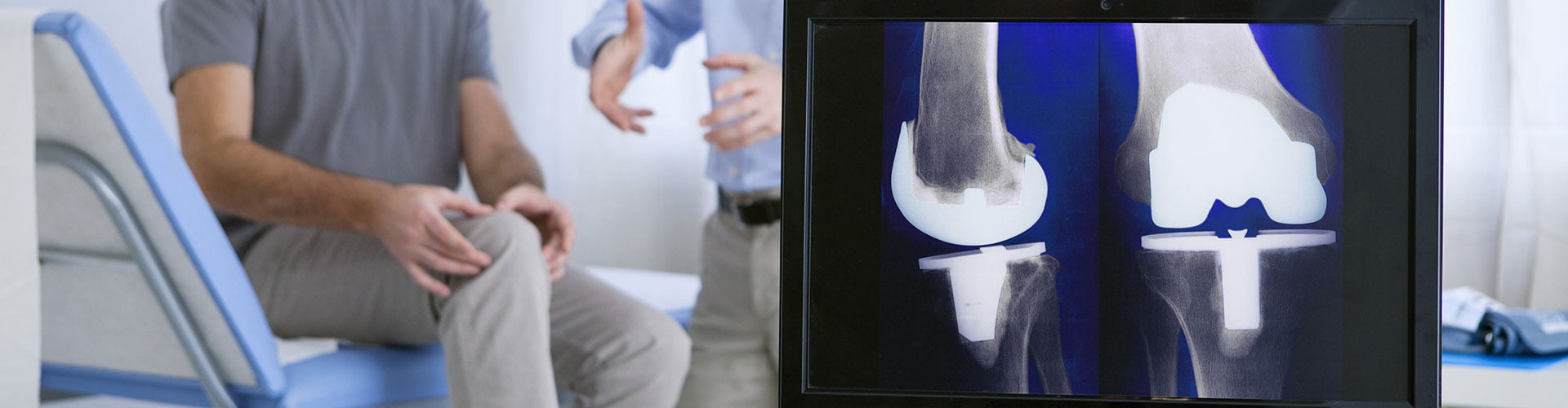 Making Custom Knee Systems with Additive Manufacturing