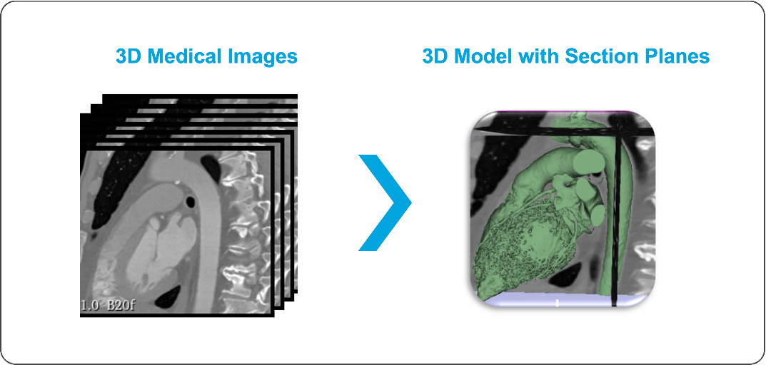 Three-Dimensional Visualization and Printing of Cardiac Anatomy for ...