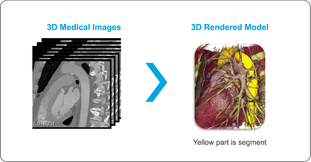 Three Dimensional Visualization And Printing Of Cardiac Anatomy For
